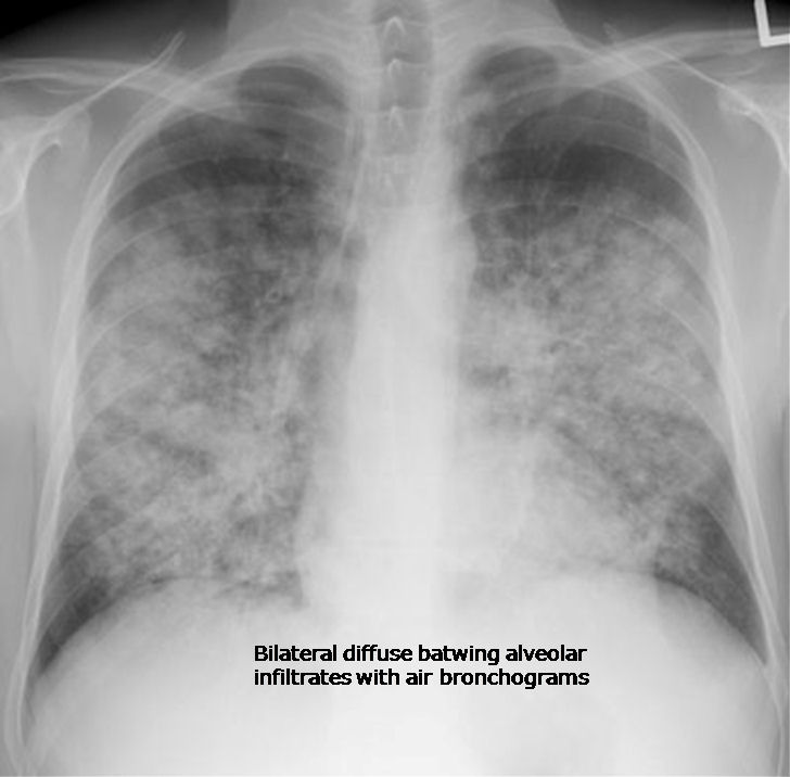 radiologyspirit-2010-08-01